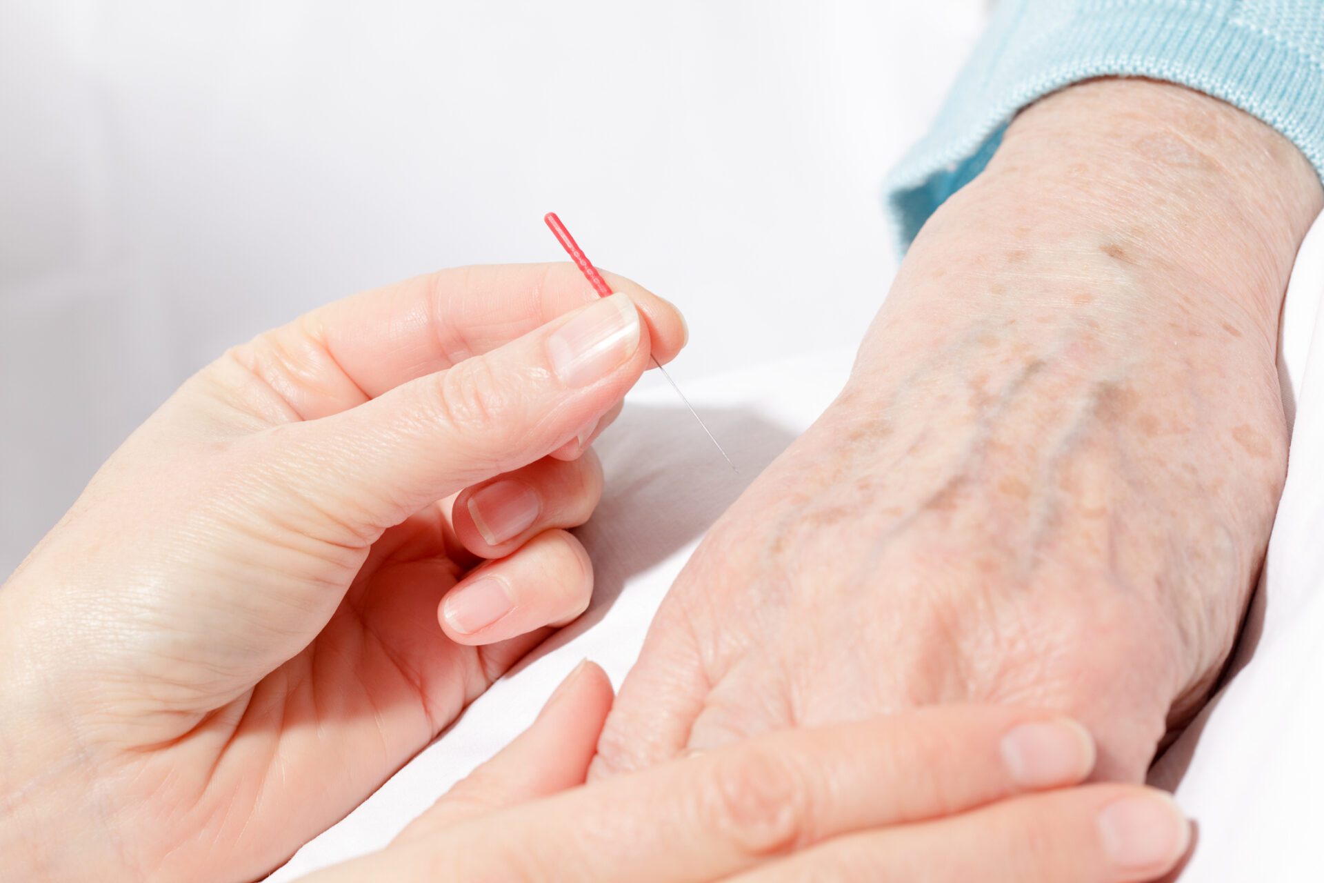 Traditional Chinese Medicine: what you need to know - The Arthritis ...