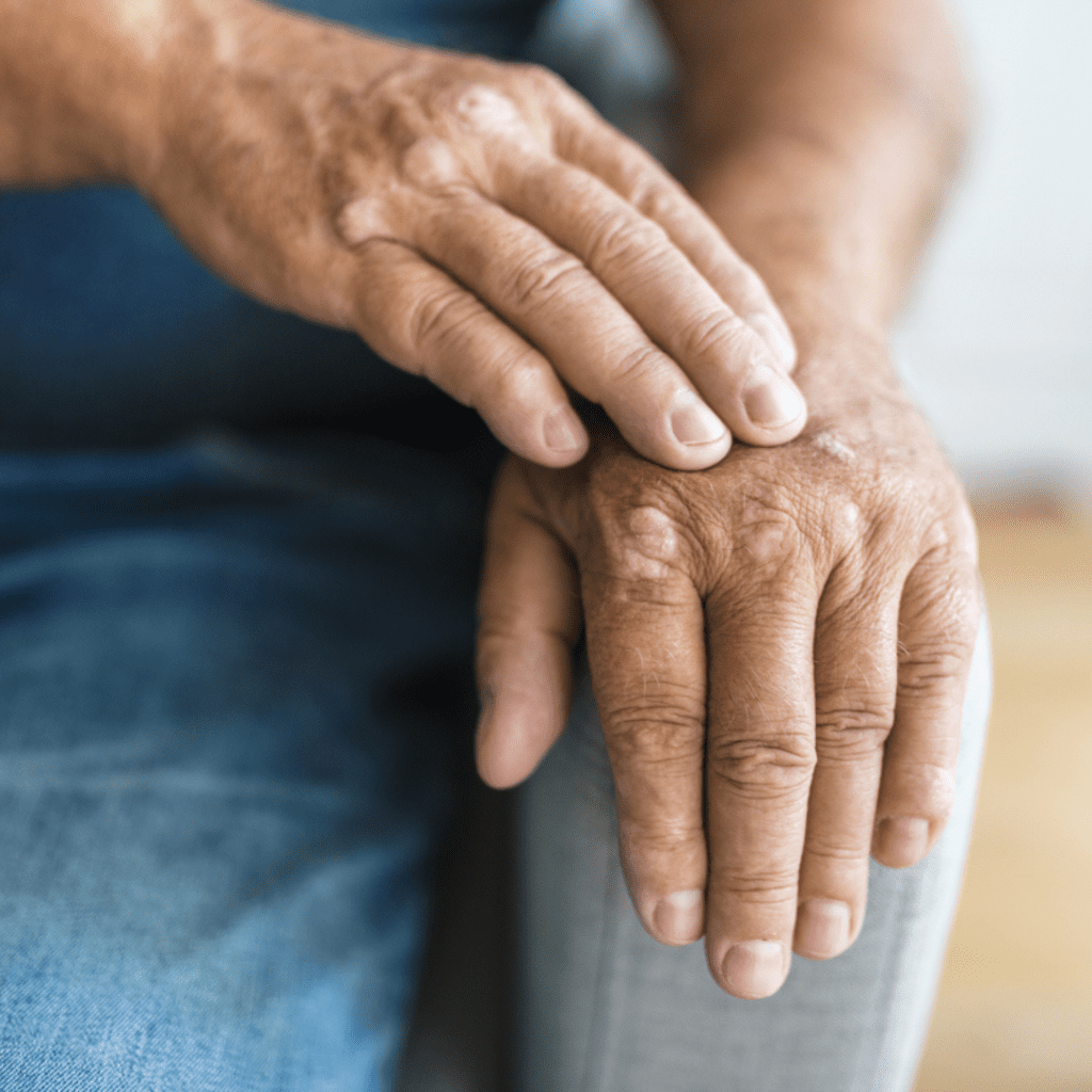 Types Of Arthritis | The Arthritis Movement
